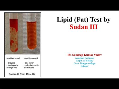 Solved Tests For Lipid Tests For Lipids Are Based On A 54 Off