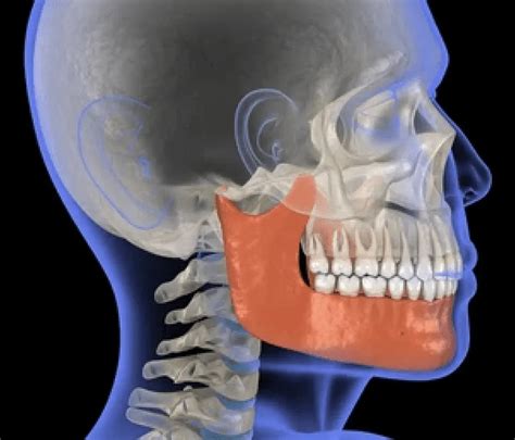 Osteomyelitis Of The Jaw Oral Pathologist Located In West Hollywood
