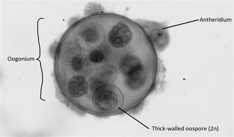 Diagrama De Oomicetos