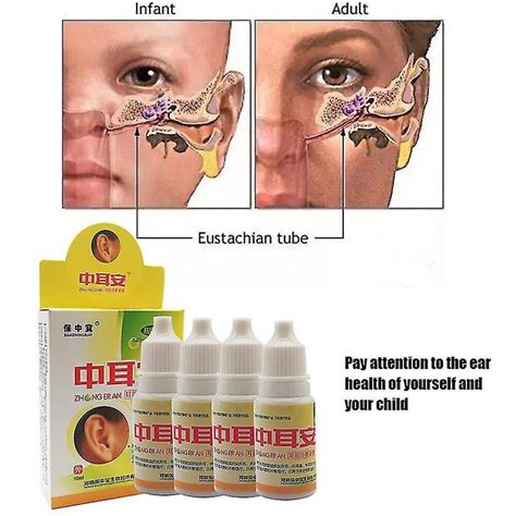 Tib 10pcs Chinese Herbal Medicine Ear Drops Earwax Cleaner Liquid Acute And Chronic Otitis