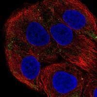 Laminin Beta 3 Antibody BSA Free NBP3 21221 Novus Biologicals
