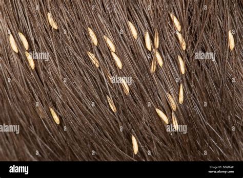 Human Bot Fly Range Map Human Bot Fly Range Map