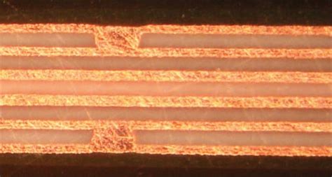 Using Lcp Based Flexible Substrates For Medical Smart Sensor