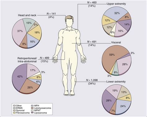Sarcomas Of Soft Tissue Clinical Gate