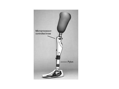 Lower Limb Prosthesis Pptx