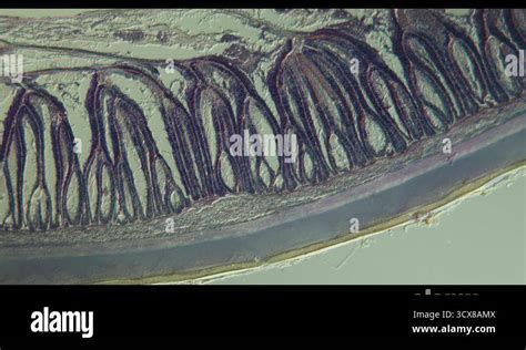 Roundworm Tissue Stock Videos And Footage Hd And 4k Video Clips Alamy