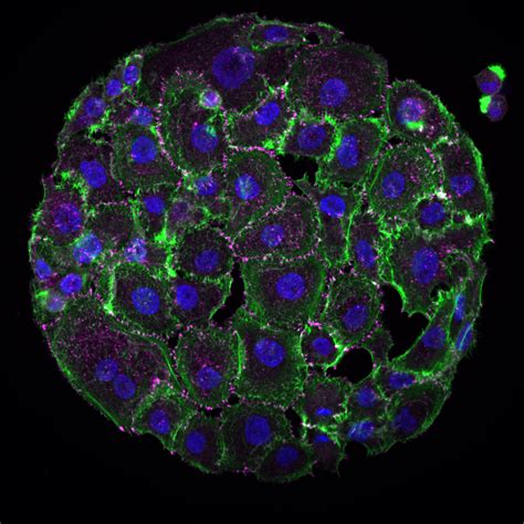 Imaging Makes Invisible Visible University Of Turku