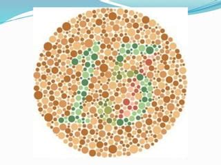 Neo Mendelian Genetics About Autosomal And Sex Linked Disorders Ppt