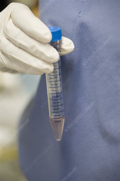 Centrifuge Tube Of Human Sperm Stock Image C Science Photo Library