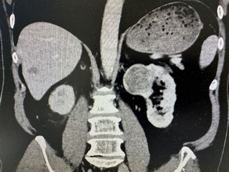 Daniar Osmonov Prof Dr Med On Linkedin Hugo