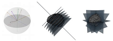 Multiplanar Unet One Unet For All 3 D Segmentation Tasks Towards Deep Learning