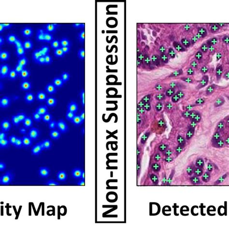 Pipeline For Detecting And Classifying Nuclei In Histology Download Scientific Diagram