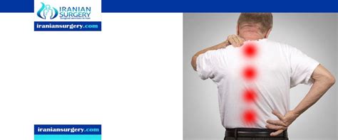 Is A Laminectomy A Major Surgery Laminotomy Success Rate