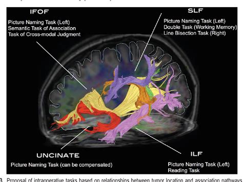Figure 1 From Selection Of Intraoperative Tasks For Awake Mapping Based On Relationships Between