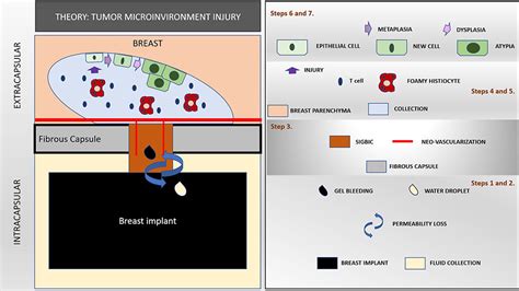 The Breast Tumor Microenvironment Could Silicone Breast Implant Elici BCTT