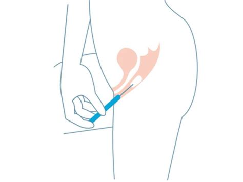 Using Human Papillomavirus HPV Detection Tests For Cervical Cancer Screening And Managing HPV