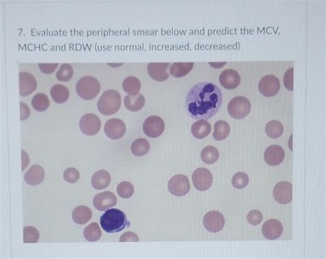 Solved 7 Evaluate The Peripheral Smear Below And Predict