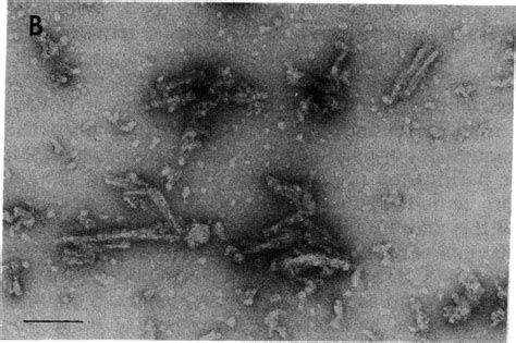Electron Micrographs Of Scrapie And Cjd Prion Rods Fractions Were