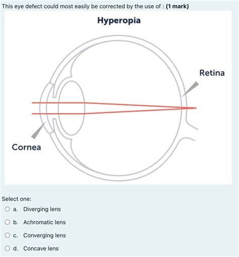 Solved This Eye Defect Could Most Easily Be Corrected By The