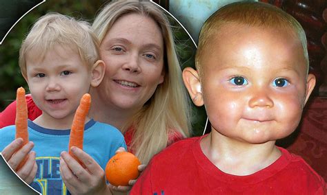 Beta Carotene Orange Skin