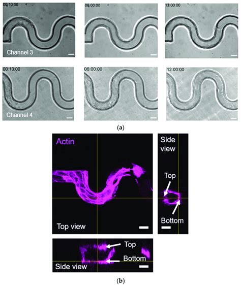 A Representative Time Lapse Images Are Showing Collective Cell Download Scientific Diagram