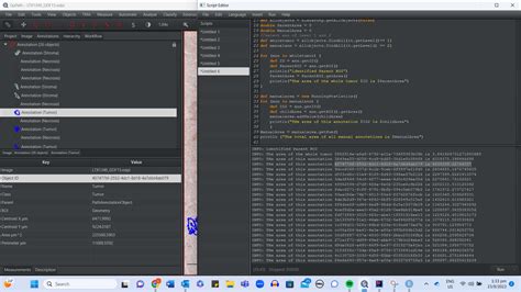 Qupath Script Error With Hierarchy Usage And Issues Imagesc Forum