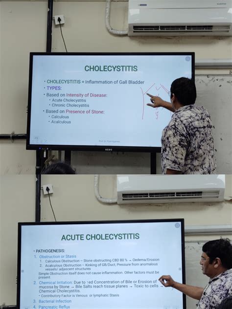 Acute Cholecystitis Pdf