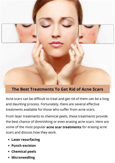 PPT The Best Treatments To Get Rid Of Acne Scars PowerPoint Presentation ID 11997047