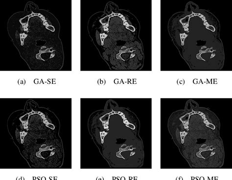 Figure 5 From Comparison Results Of Medical Image Segmentation With