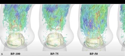 Computational Modeling Enables Heart Valve Visualizations Science Codex