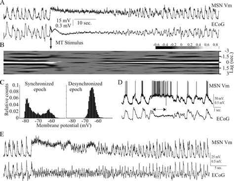 A Traces Of A Simultaneous Recording Of A Msn And The Frontal Ecog Download Scientific