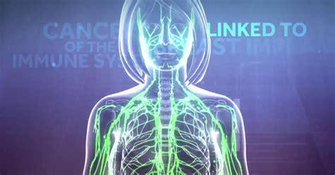 Doctors Patients Raise Alarms About Cancer Linked To Breast Implants