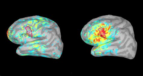 Functional Connectivity 39 By Ypathak Discussions Brainstorm