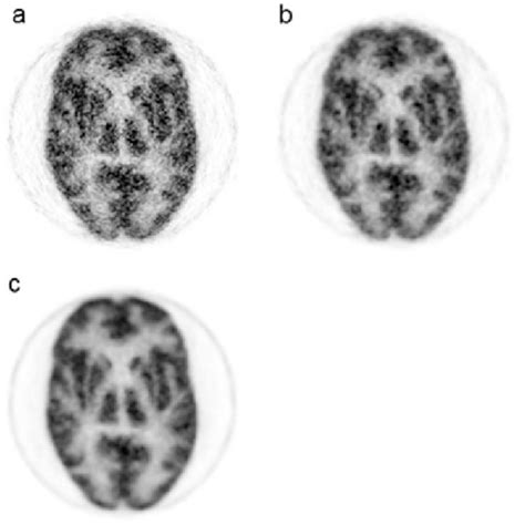 4 Reconstructed Image Of Hoffman Phantom A Anw Osem B Anw Osem Download Scientific