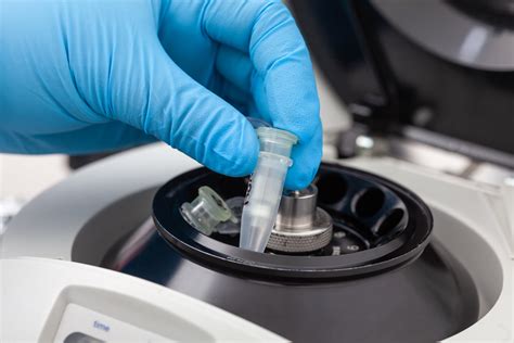 Optimizing Rna Yield In Column Based Extraction The Critical Factor
