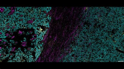 From Image To Results Enabling 3d Multiplexing Spatial Omics Workflows In Neuroscience