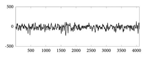 sample of eeg signal from bonn university dataset a class z b