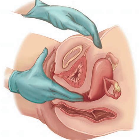 HA PrepU 24 Flashcards Quizlet