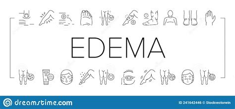 Edema Disease Symptom Collection Icons Set Vector 241642446