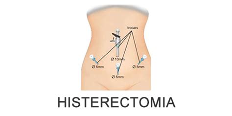 Dr Douglas Ribeiro Ginecologia Cirurgia Ginecológica