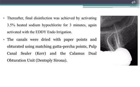 Glide Path In Endodontics Pptx