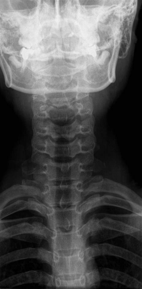 Ucsd Musculoskeletal Radiology