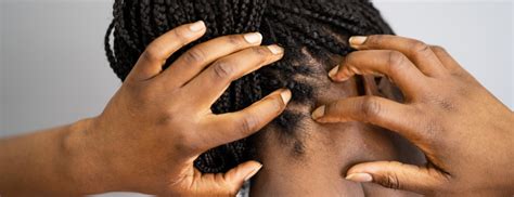 How To Combat Scalp Itch Original Moxie
