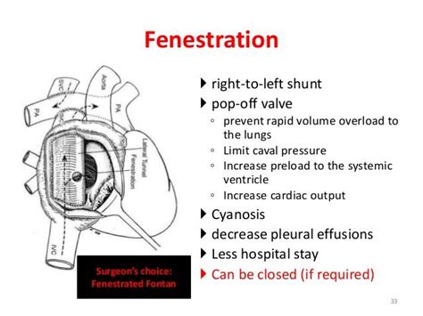 Épinglé Sur Fontan Fenestratednon Fenestrated
