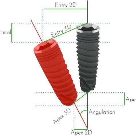 Deviation Outcomes Deviation Between The Planned Position And The Download Scientific Diagram