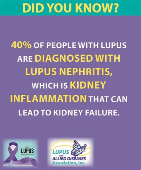 Lupus Association On Twitter Forty Percent Of People With Lupus Are Diagnosed With