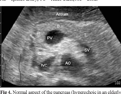 Figure 4 From Ultrasound Examination Of The Normal Pancreas Semantic