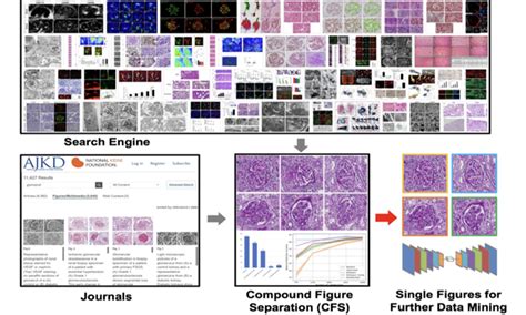 Compound Figure Separation Of Biomedical Images Mining Large Datasets For Self Supervised