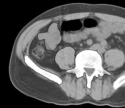 In Practice Contours Obtained Using Graph Pruning A Are Almost Download Scientific Diagram