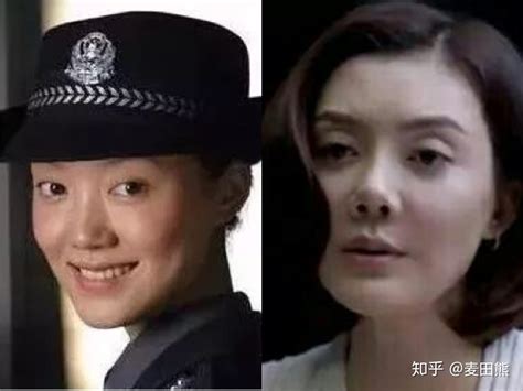 那些整容过度的明星，现在都成了什么样？ 知乎